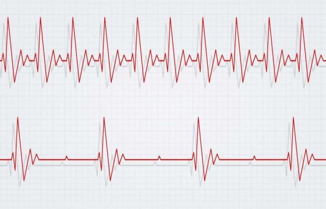 Angina in females | 6 Warning Signs & Symptoms of Angina in females ...