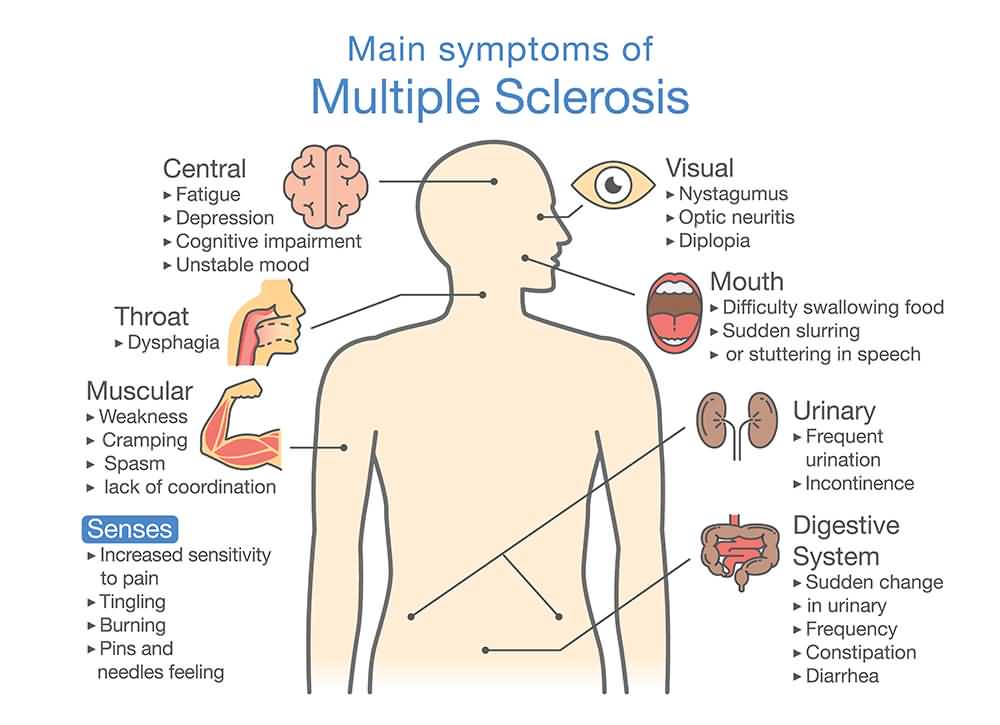 What Is Multiple Sclerosis And What Are The Symptoms