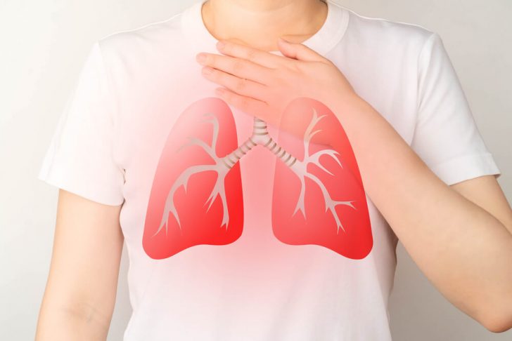 Pulmonary Edema | Symptoms, Causes and Treatment - Healthella