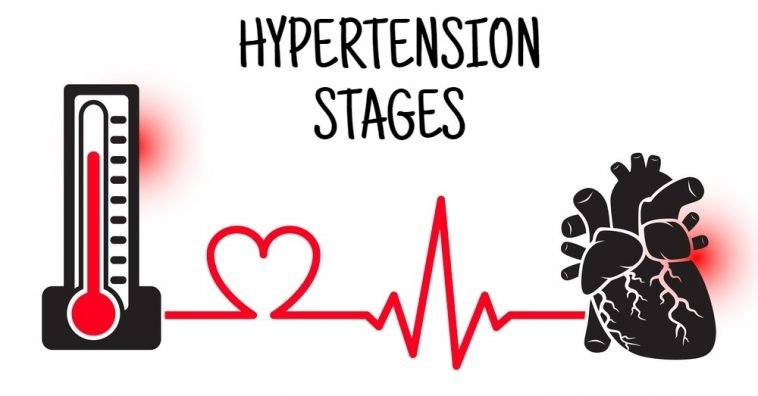 Stages of Hypertension & Treatment Plan According To Your Stage ...