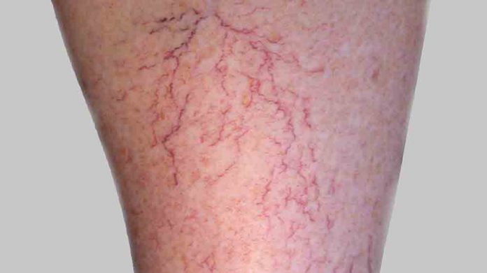When to Worry about A Rash in Adults? - Healthella