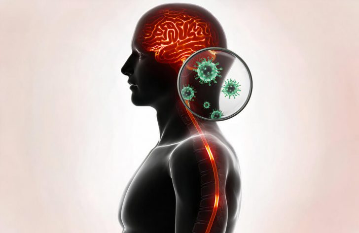 Spinal Meningitis | Causes, Symptoms and Signs, Risk Factors, Diagnosis ...