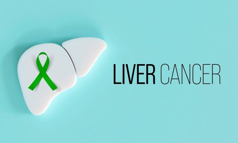 Liver Cancer | Causes, Symptoms, Diagnosis & Treatment Options - Healthella