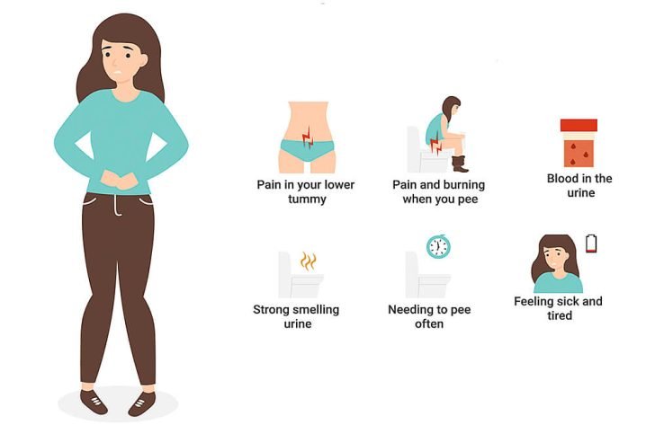 Bladder Inflammation (Cystitis) : Symptoms, Causes, Types, Diagnosis ...